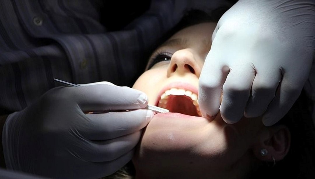 Endodonti nedir, nasıl yapılır? Endodonti hakkında bilgiler - Sağlık ...