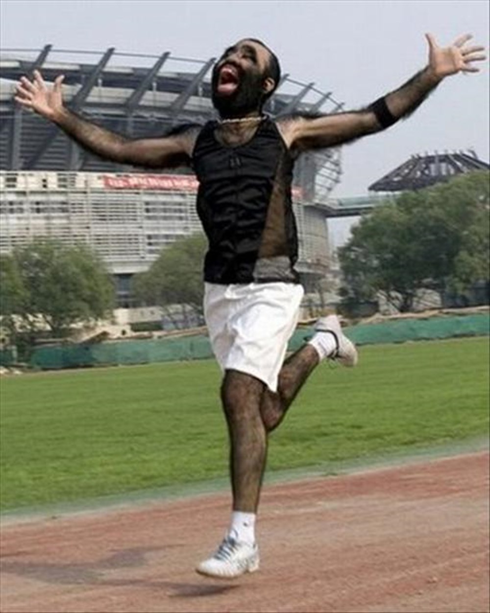 ‘Maymun adam’a estetik - Son Dakika Yaşam Haberleri | NTV Haber