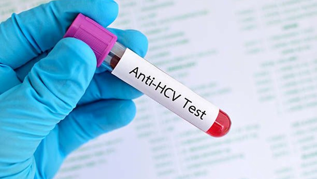 Anti HCV nedir? - Sağlık Haberleri