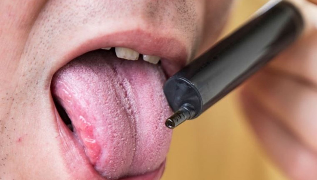 67 yaşındaki dil kanseri hastası uyardı: Bu küçük belirtiyi asla hafife ...