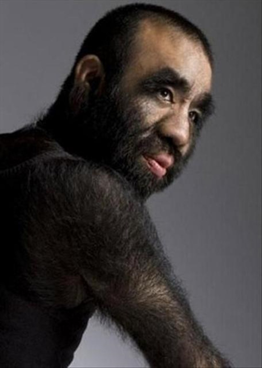 ‘Maymun adam’a estetik - Son Dakika Yaşam Haberleri | NTV Haber