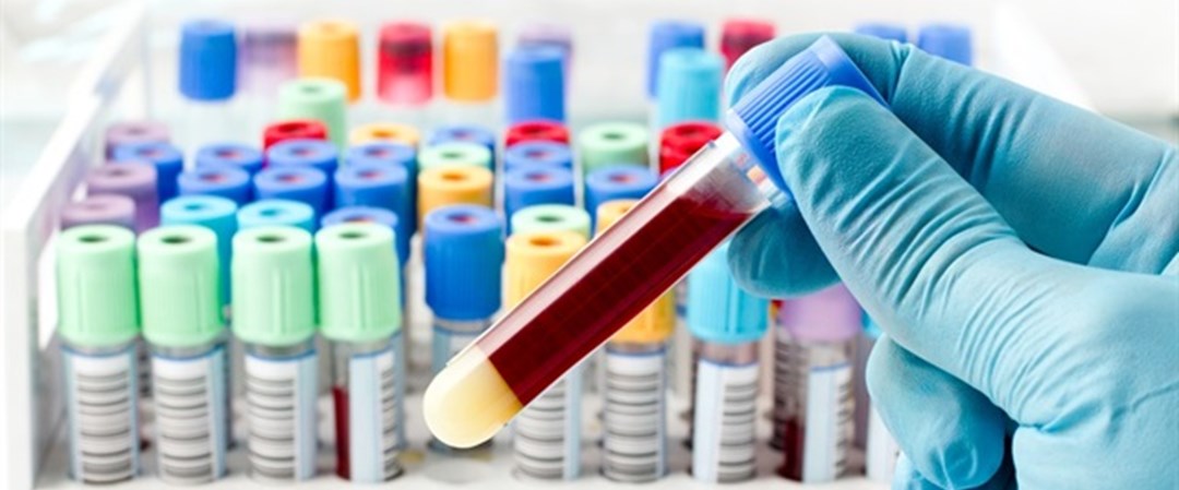 Kanser tedavisinde yeni immünoterapi ilacı - Sağlık Haberleri